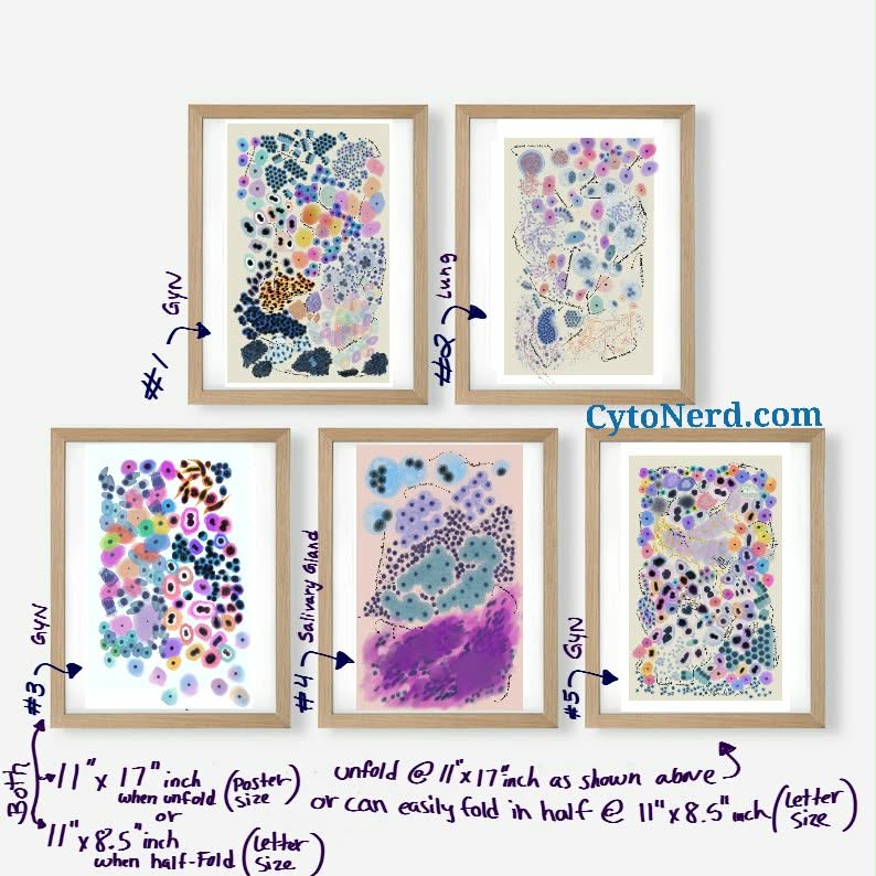 Salivary gland Poster, Pleomorphic adenoma poster, Cytology cells art