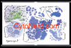 Cytology art prints, cells cytology painting, pathology laboratory art ...